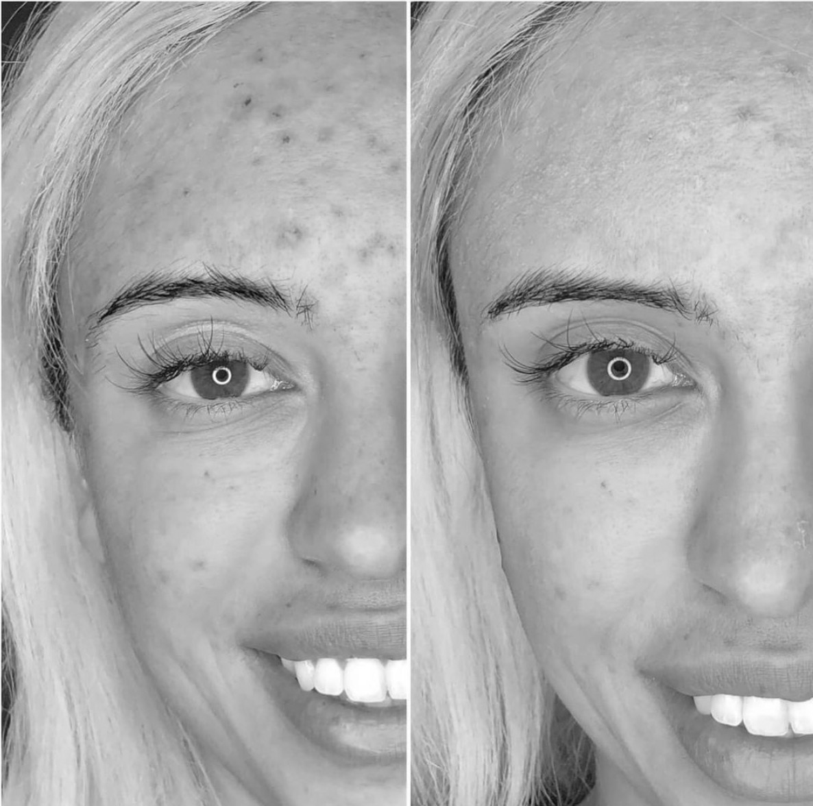 The SaltFacial: Everything You Need to Know About It