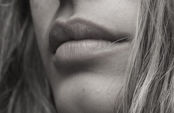 LipLase LA: Laser Lip Plumping at MedBeautyLA