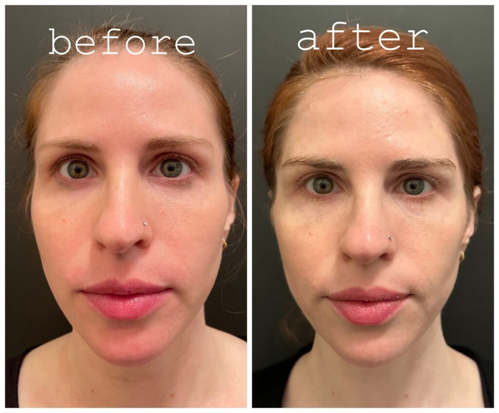 Skinvive Before and After: Real Photos