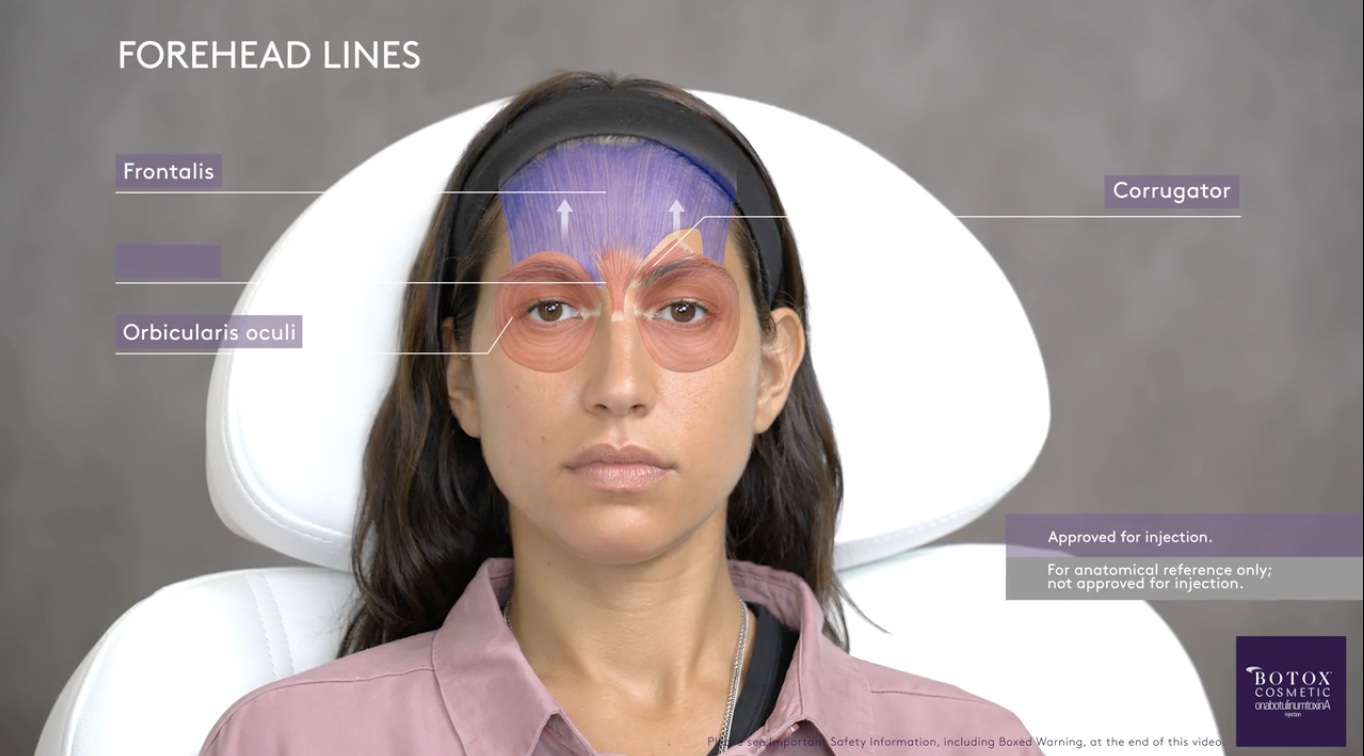 Botox® Eye Lift in Los Angeles: Expert Injectors at MedBeautyLA